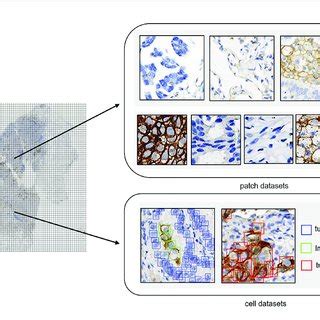 Annotation Dataset For Tumor Detection Patch Datasets And Cell Download Scientific Diagram