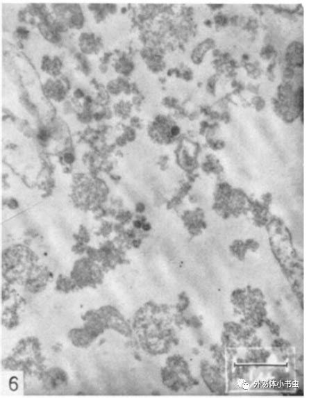 【jev】细胞外囊泡研究简史 黄灿华教授 实验室