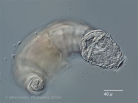 Bdelloid Rotifers By Aydin Örstan And Michael Plewka Quekett