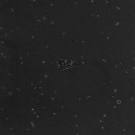 Detect Cells Instance Segmentation Model By Stage