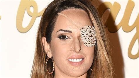 Gessica Notaro Contro Gli Haters «la Chirurgia Estetica Mi Ha Salvato La Vita Vanity Fair