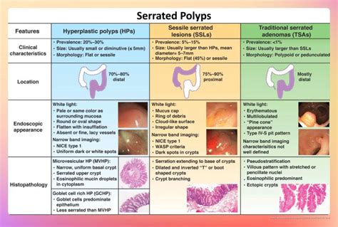 Endocollab™ Gastroenterology And Endoscopy Education On Linkedin Classification Of Serrated