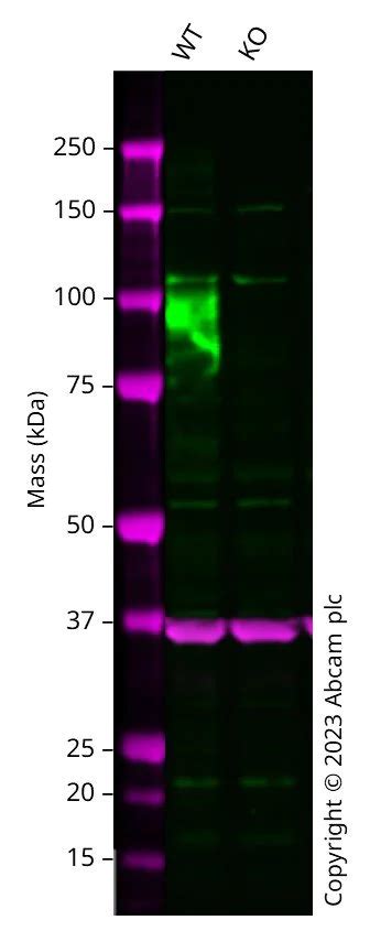 Anti Cd68 Antibody Rm1031 Macrophage Marker Ab303565 Abcam