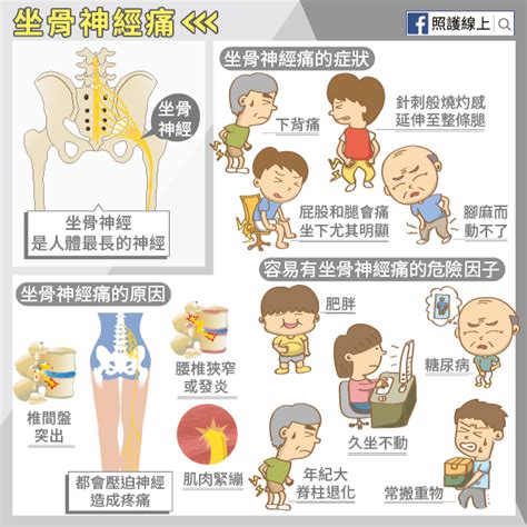 坐骨神經是全身最長的神經，一 台南柏拉圖徒手保健 脊椎筋骨健康的專業，電腦手機族、辦公族、運動族、辛勞家管族的福音