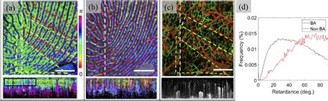 Figure 3 From Polarization Sensitive Optical Coherence Tomography For Imaging Microvascular