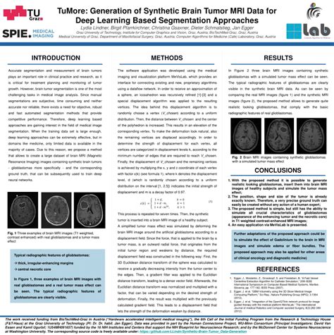 PDF TuMore Generation Of Synthetic Brain Tumor MRI Data For Deep Learning Based Segmentation