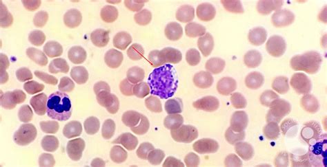 Basophil