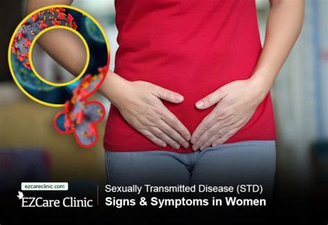 Sexually Transmitted Disease STD Signs Symptoms In Women