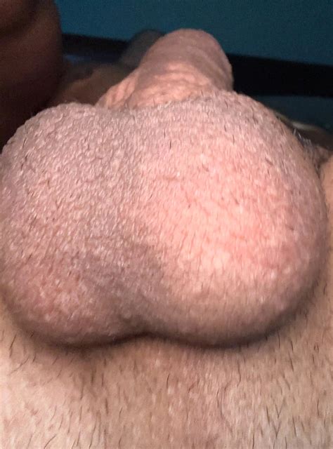 Like A Volcano About To Explode ðŸ¤¯ Nudes Balls Nude Pics Org