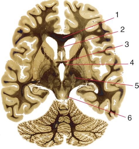 Cortex Axial Cross Sections 6 Diagram Quizlet