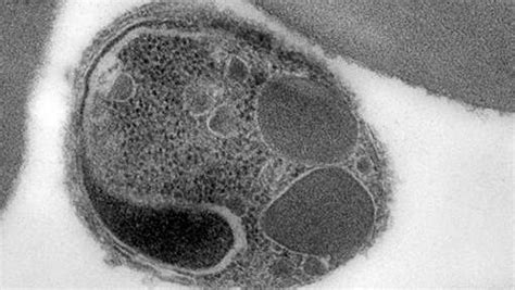 A Two Pronged Approach To Target Critical Malaria Protein Worlds