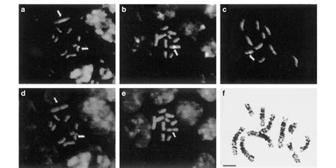Cma 3 And Dapi Staining And C Banding Of Metaphase Chromosomes
