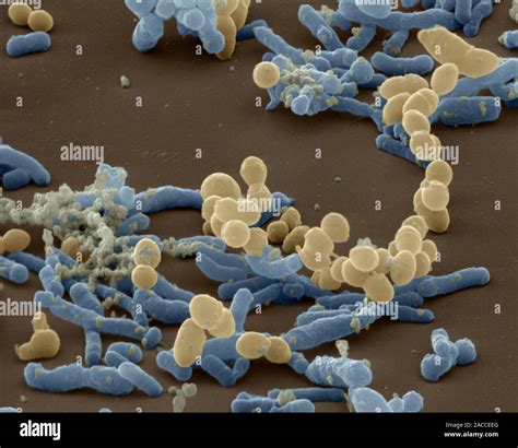 Lactobacillus Bacteria Coloured Scanning Electron Micrograph Sem Of