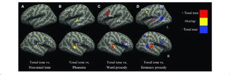 Conjunction And Contrast Maps Between Tonal Tone And Other Conditions