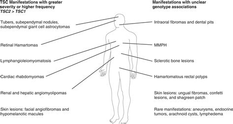 Tsc1 And Tsc2 Genotype In Tuberous Sclerosis Complex Are Other Manifestations Of This