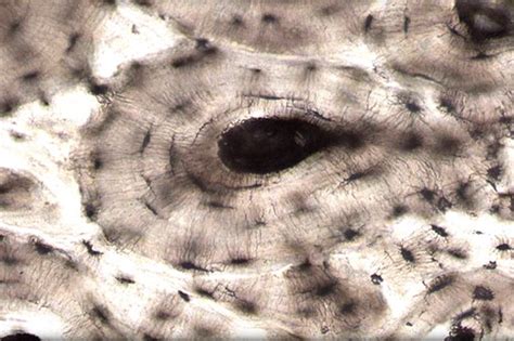 Anatomy Lab 3 Bone Microstructure 3 Flashcards Quizlet