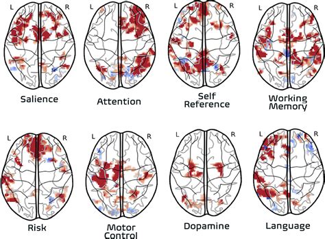 Frontiers Editorial Functional Neuroimaging In Psychiatric Practice