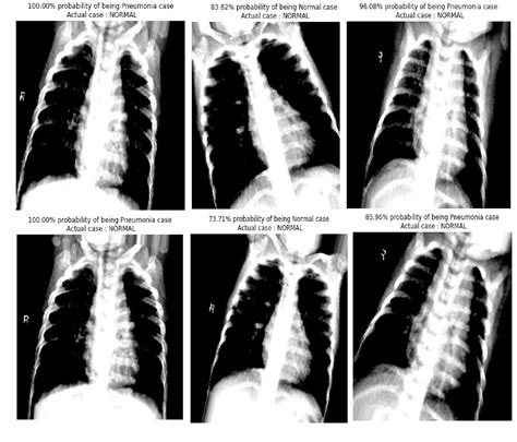 Figure 12 From Designing Optimal Convolutional Neural Network Architecture Using Differential