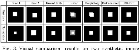 Figure 3 From 3 D Medical Image Interpolation Via Multi Resolution