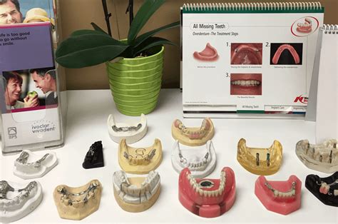 Process Of Getting Dentures Five Steps To Getting Dentures Made Yyexf