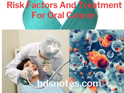 Risk Factors And Treatment For Oral Cancer Bds Notes