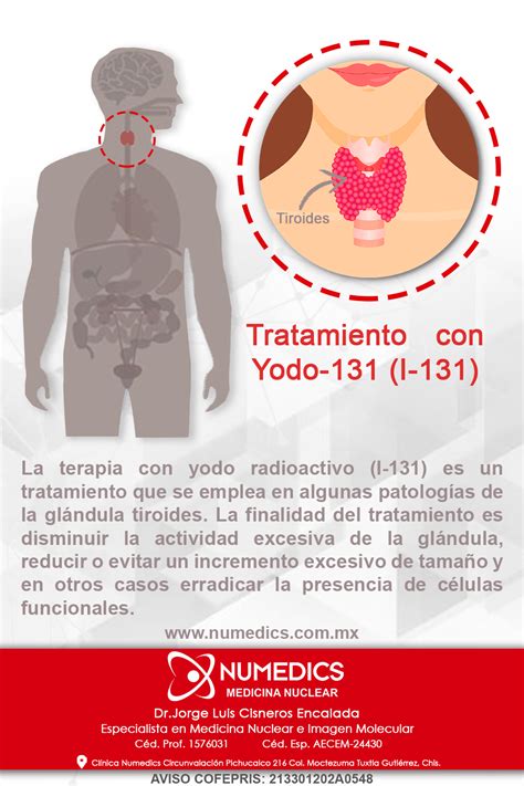 Tratamiento Con Yodo Medicina Nuclear De Chiapas