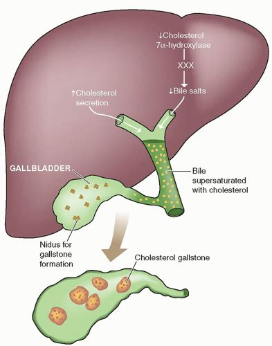 The Gallbladder And Biliary System Radiology Key