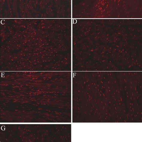 A G Detection Of Superoxide In Myocardium By Dihydroethidium Dhe