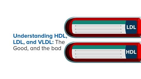 Understanding Hdl Ldl And Vldl Cholesterol Levels Understanding Hdl Ldl And Vldl Cholesterol Levels