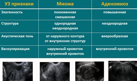 Ультразвуковая диагностика в гинекологии в соответствии с клиническими ...