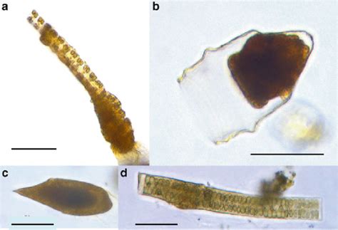4 Examples Of Heterotrophic Protist Morphotypes Observed In Western Download Scientific Diagram