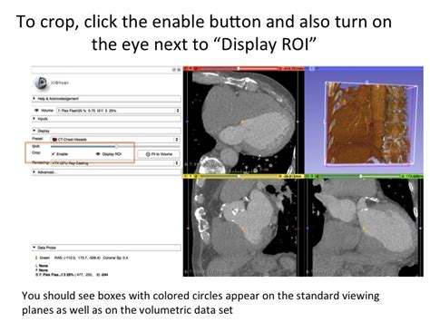 Navigating 3d Slicer 101 Basic Introduction To Slicer Software And