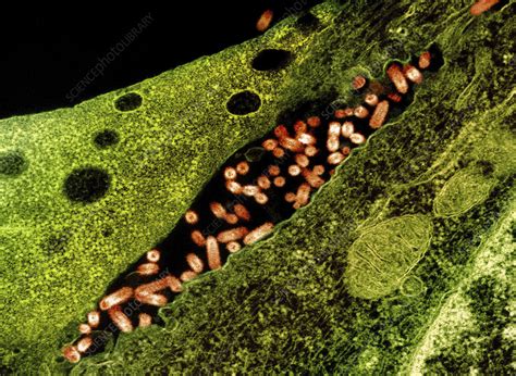 Vesicular Stomatitis Virus Infection Tem Stock Image C059 4033 Science Photo Library
