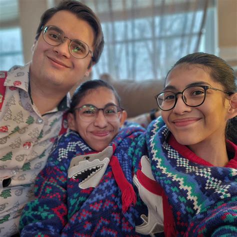 Conjoined Twins Carmen Lupita Andrade Answer Questions In Video Us