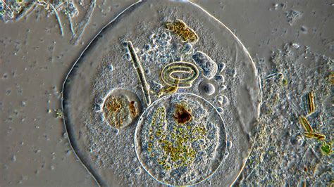 Una Ameba Comecerebros Causó La Muerte De Un Niño En Estados Unidos