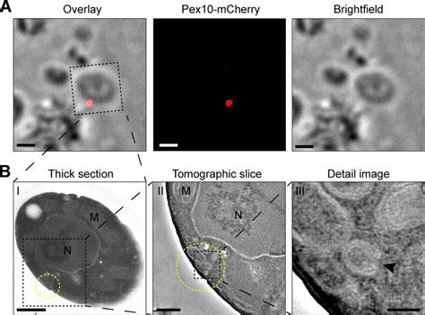 Clem Revealed The Presence Of Clusters Of Membrane Structures At