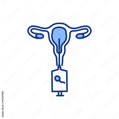 Artificial Insemination Rgb Color Icon Pregnancy Achieving Vivo