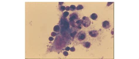Figure Of Target Sarcoma Cell Attacked By Small Compact Immune T Cells Download Scientific