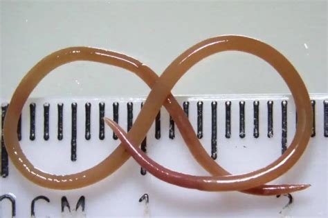 Live Worm Found In Australian Womans Brain Zoonotic Diseases