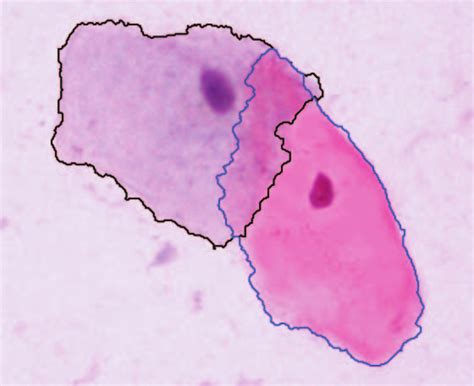 A The Boundaries Of The Cell Cluster And The Nuclei After The Nuclei