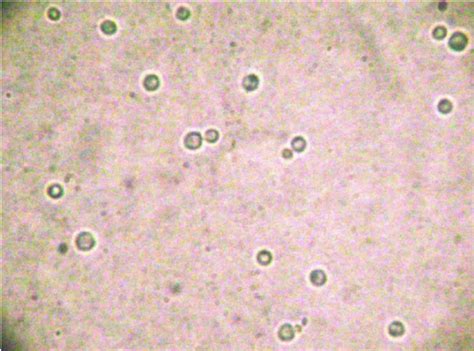 India Ink Preparation Showing Encapsulated Budding Yeast Cells Of