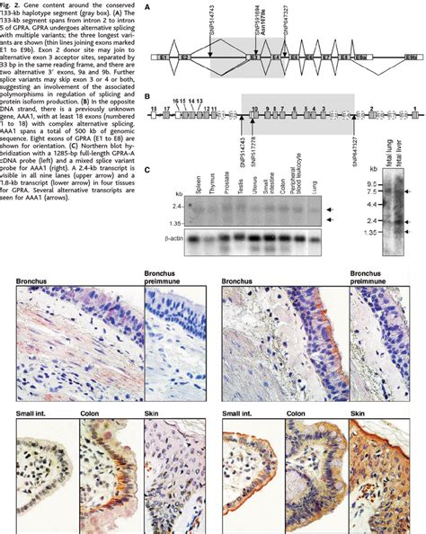 Expression Of The A Left And B Right Isoforms Of GPRA As Download Scientific Diagram