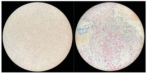 Hpv Rnascope Negative Left Positive Right Download Scientific Diagram