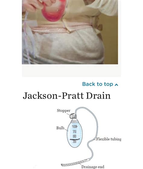 Jackson Pratt Drain Mastectomy