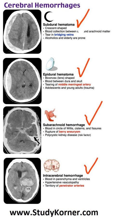 Intracranial Hemorrhage Rfoamed911