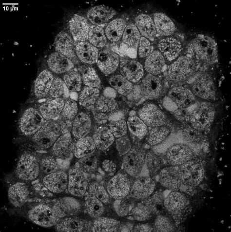 Segmenting Densely Packed Nuclei In 3d Image Analysis Imagesc Forum