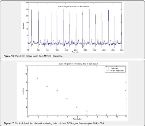 Figure 17 From Removal Of The Power Line Interference From Ecg Signal