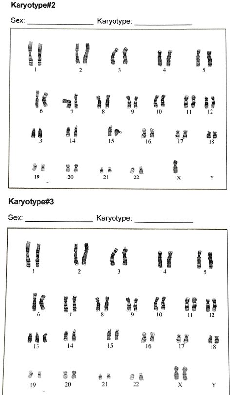 Solved Karyotype 2 Sex Karyotype Karyotypen3 Sex Karyotype V 0
