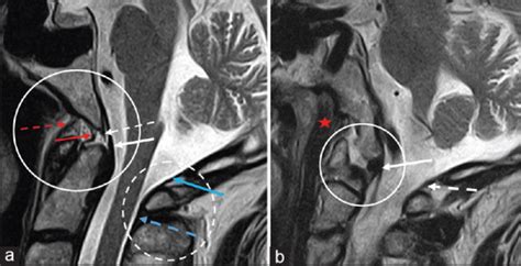 Anatomic Functional And Radiographic Review Of The Ligaments Of The