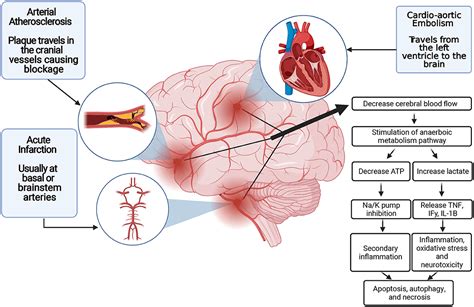 Frontiers Neuroprotection In Acute Ischemic Stroke A Battle Against